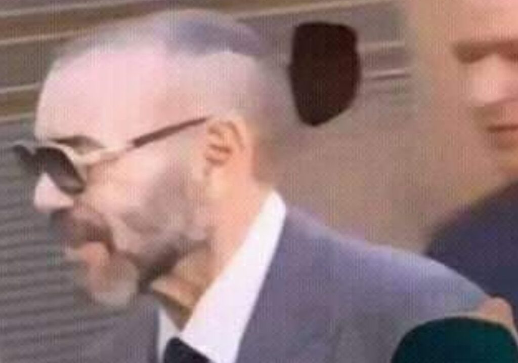 King Mohammed VI's Health: The Revealing Image that Sparked Concern - Watan